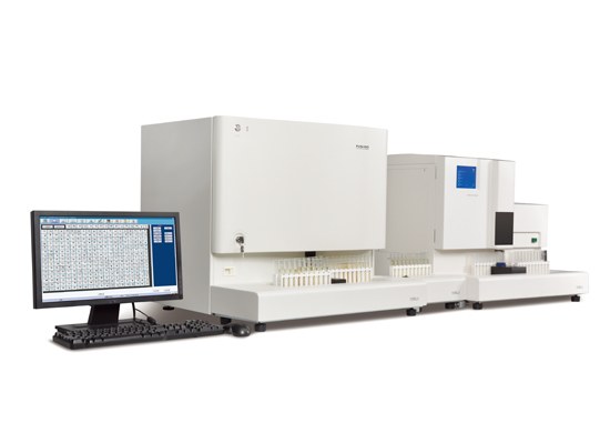 Urine Analyzer - Smart Medical EG products