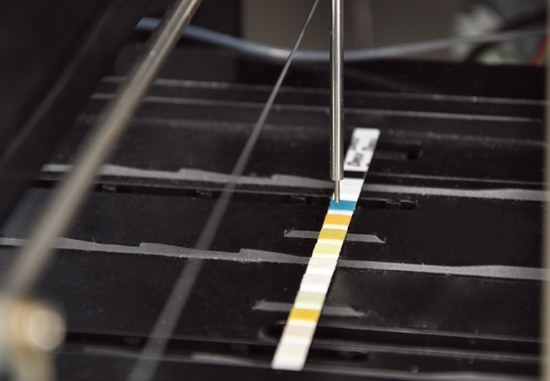 Urine Analyzer - Smart Medical EG products